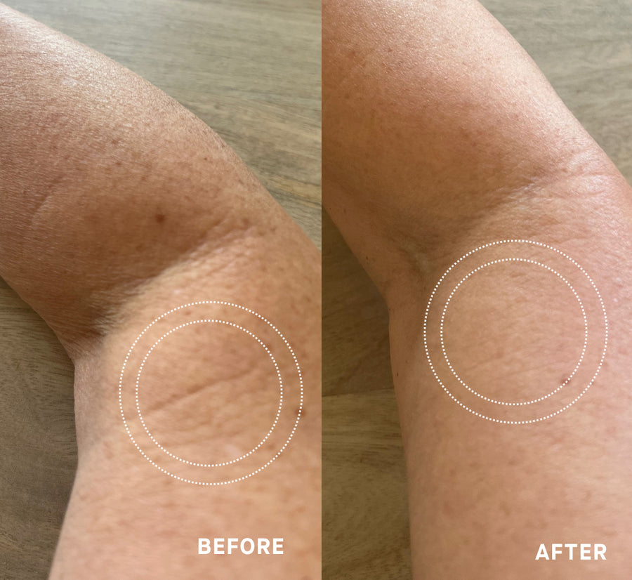 OS-01 BODY Topical Supplement – OneSkin