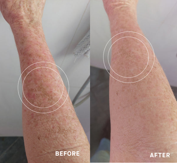 OS-01 BODY MOISTURIZER – OneSkin