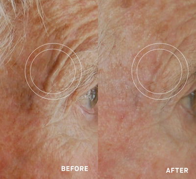 Topical Supplement: Face Moisturizer with Peptides | OneSkin