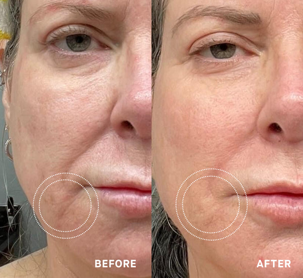 Topical Supplement: Face Moisturizer with Peptides | OneSkin