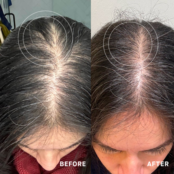 OS-01 HAIR SCALP SERUM – OneSkin