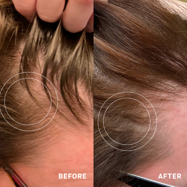 OS-01 HAIR SCALP SERUM – OneSkin