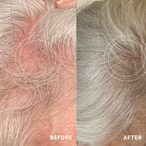 OS-01 HAIR SCALP SERUM – OneSkin