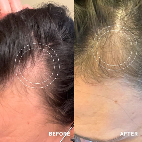OS-01 HAIR SCALP SERUM – OneSkin