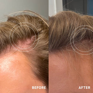 OS-01 HAIR SCALP SERUM – OneSkin