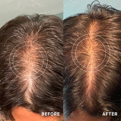 OS-01 HAIR peptide scalp serum – OneSkin