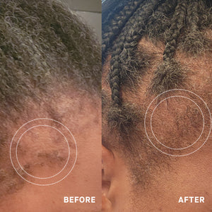 OS-01 HAIR SCALP SERUM – OneSkin