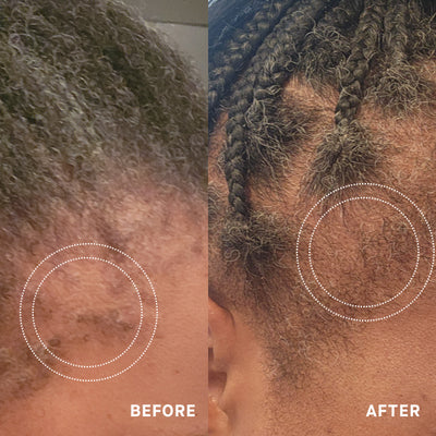 OS-01 HAIR SCALP SERUM – OneSkin