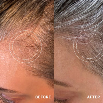 OS-01 HAIR peptide scalp serum – OneSkin