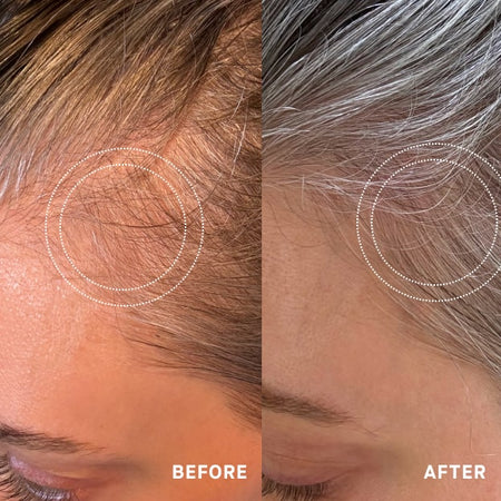 OS-01 HAIR peptide scalp serum – OneSkin