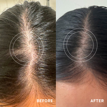 OS-01 HAIR peptide scalp serum – OneSkin